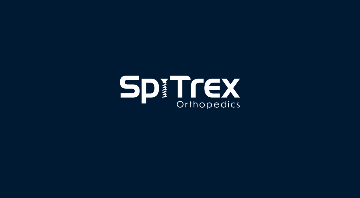 Simplified Processes To Your Benefit - SpiTrex Orthopedics
